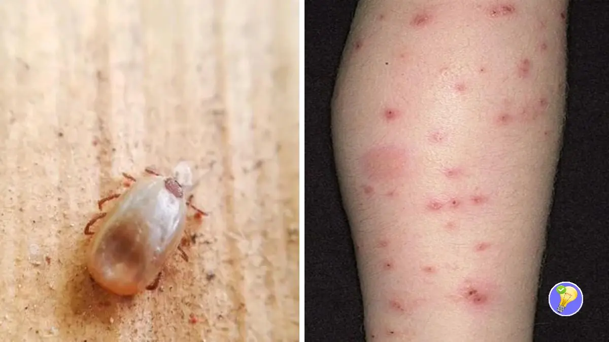 Puces de Parquet : Comment les Combattre Efficacement