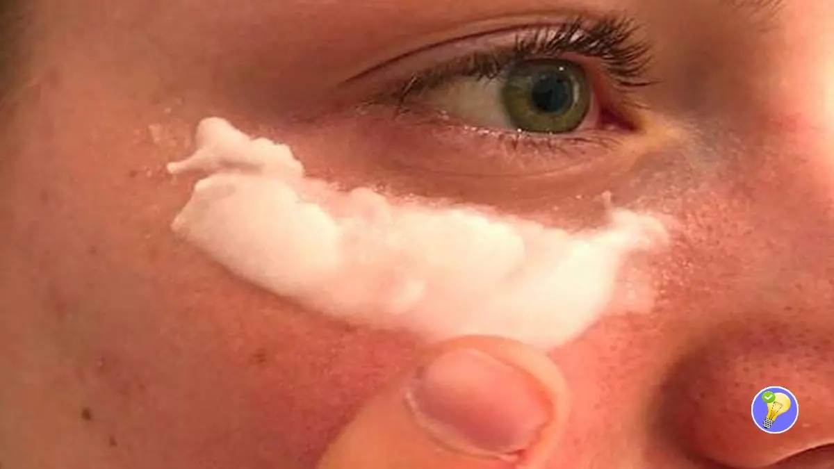 Démangeaison Des Yeux : Causes, Que Faire – OVFRQ