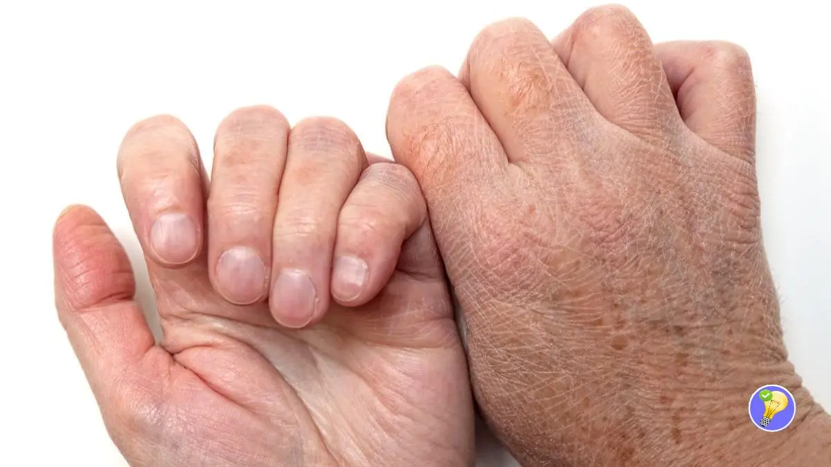 Mains Sèches : Soignez-les avec 5 Remèdes Naturels
